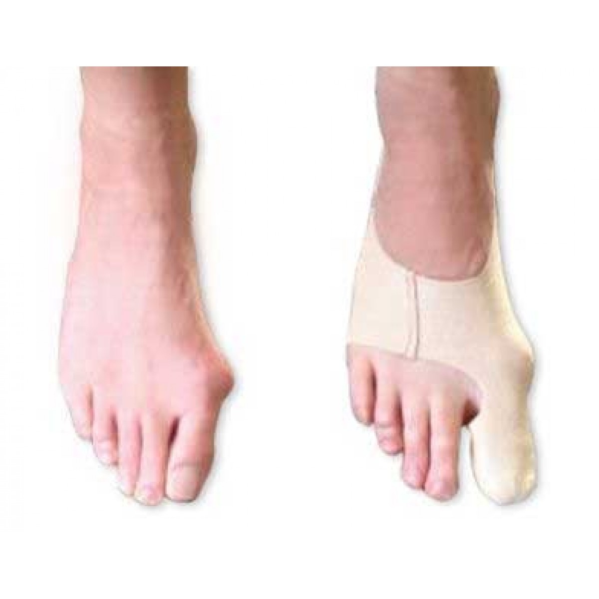 Διορθωτικό καλτσάκι για κότσι Hallux Valgus ημέρας-νύχτας